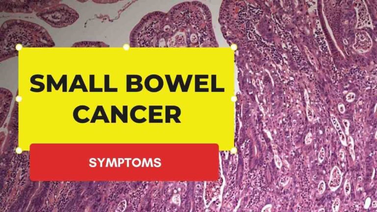 Be Careful With These 8+ Small Bowel Cancer Symptoms